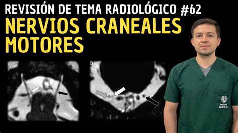 Revisión De Tema 62 Nervios Craneales Motores Youtube