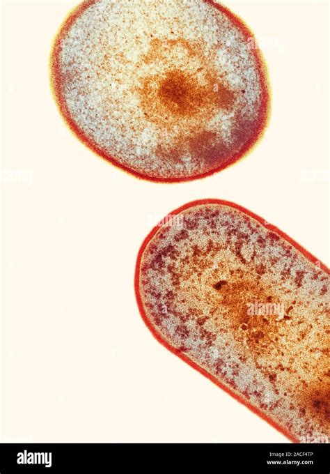 Clostridium Difficile Bacteria Coloured Transmission Electron Micrograph Tem These Gram