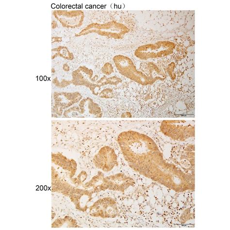 Solarbio K111111p Anti Sema3a Polyclonal Antibody 试剂仪器耗材