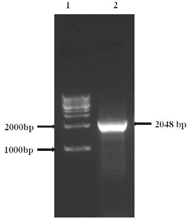 Agarose Gel 1 5 Showing 18S RRNA Gene Amplification Of Thelohanellus