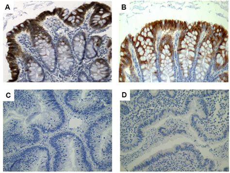 The Paracrine Hormone For The Gucy2c Tumor Suppressor Guanylin Is