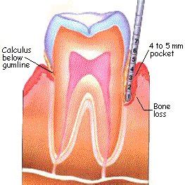 PDF Haptics Based Virtual Reality Periodontal Training Simulator