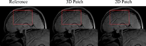 Accelerating Magnetic Resonance Parametric Mapping Using Simultaneously Spatial Patch Based And