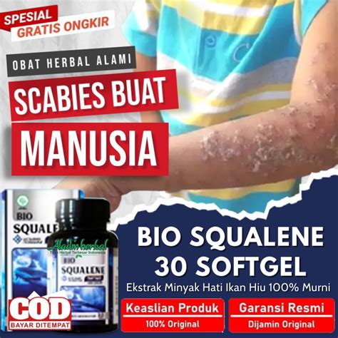 Jual Obat Scabies Manusia Terlaris Obat Gatal Scabies Obat Gatal