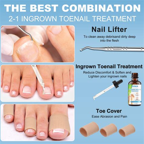 Ingrown Toenail Home Treatment Ingrown Toenail Nhs Inform