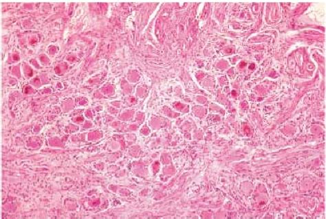 Pseudounipolar Neurons With Different Size Localized In Separate Zones Download Scientific