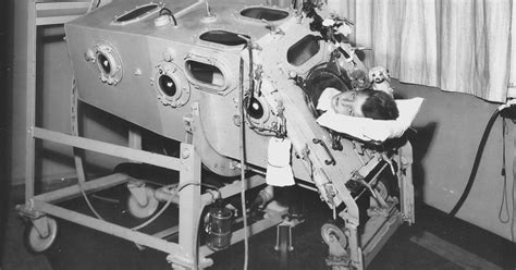 How The Iron Lung Transformed Polio Care — Bunk History