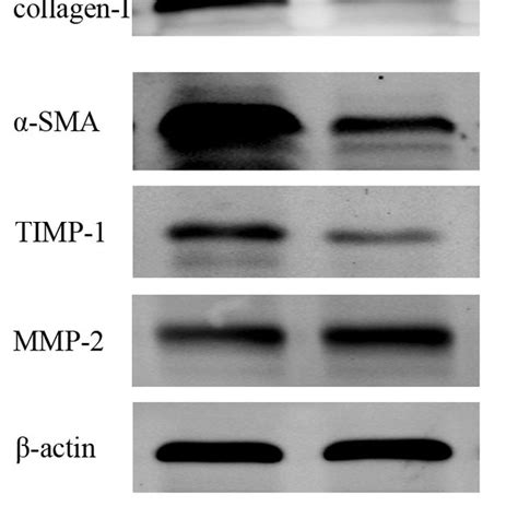 Effect Of Ghrelin On Ccl4 And Bdl Induced Liver Fibrosis A Ghrelin