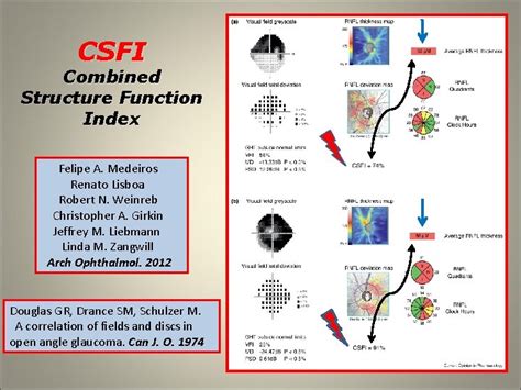 Il Glaucoma Oltre Tricase 160514 Structure And Function