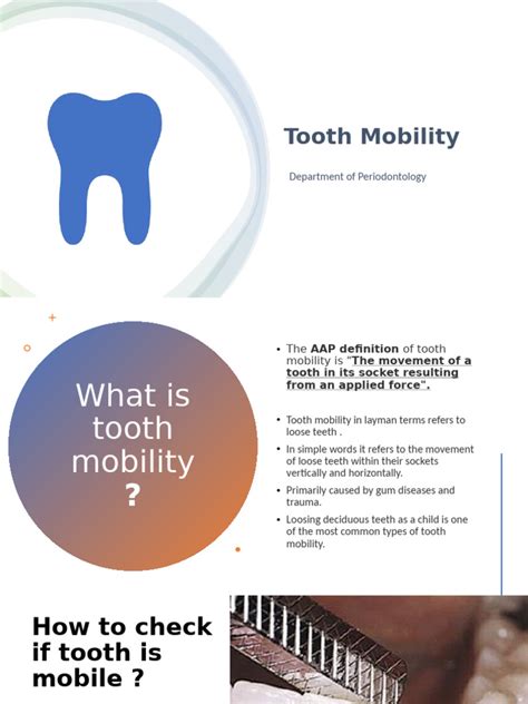 Tooth Mobility 1 Pdf Human Tooth Periodontology