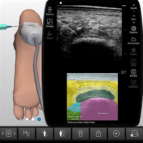 Plantar Fascia Ultrasound Guided Injections Procedure Module