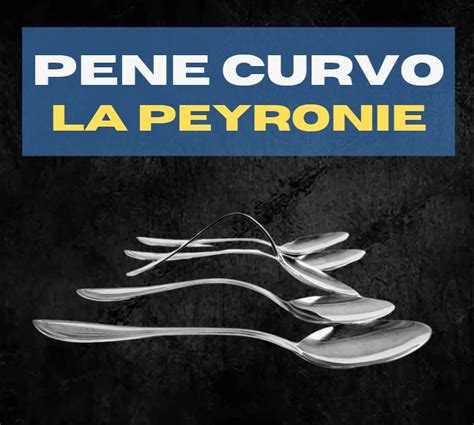 Por qué algunos varones nacen con el pene curvo Urología Peruana Dr Susaníbar