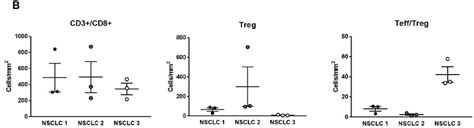Detecting Tissue Resident Reminiscence T Cells In Stable Tumors