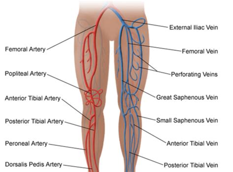 Exam 2 Peripheral Vascular Disease Flashcards Quizlet