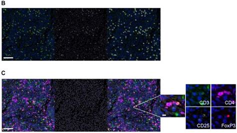 Detecting Tissue Resident Memory T Cells In Solid Tumors