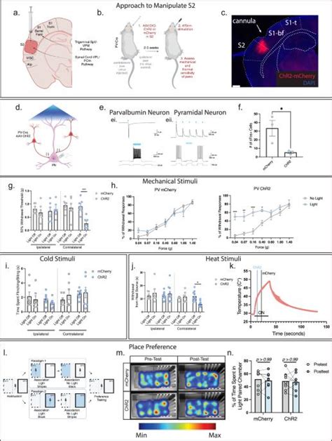 Daniel Taub Phd On Linkedin The Secondary Somatosensory Cortex Gates