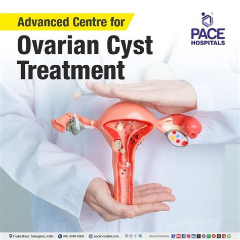 Best Ovarian Cyst Treatment In Hyderabad India Surgery And Cost