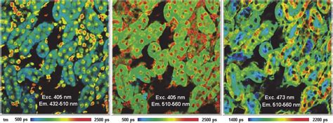 9 Flim With Excitation Wavelength Multiplexing 405 Nm And 473 Nm Download Scientific Diagram