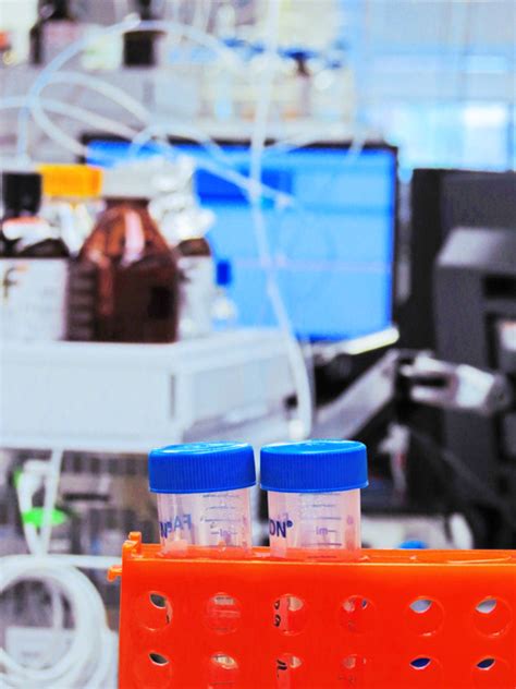 Discovery Based Metabolomics Reveals Mblac1 Functionality Center For Innovative Technology