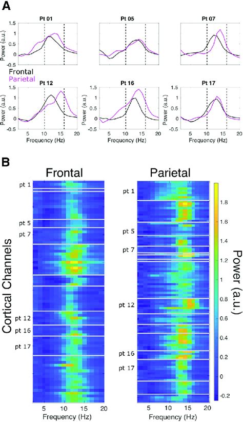 Spindle Psds For Frontal And Parietal Cortex Six Patients Had At Least Download Scientific