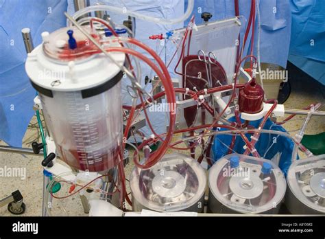 Heart Lung Machine Cardiac Pump Heart Surgery Surgeons Hospital Stock
