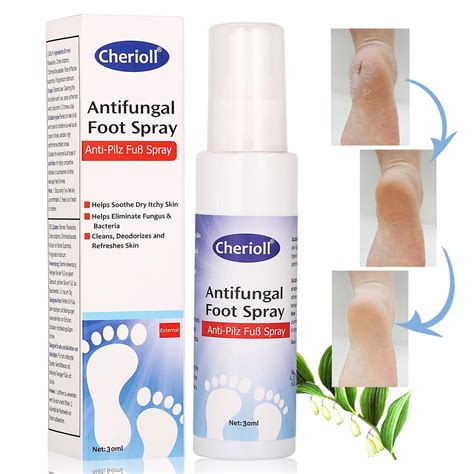 Buy Athletes Foot Spray Antifungal Deodorant Antifungal Foot Spray