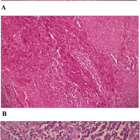 A Histopathological Examination 100× B Histopathological