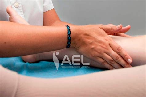 El Linfedema Una De Las Secuelas MÁs Discapacintantes Del Tratamiento