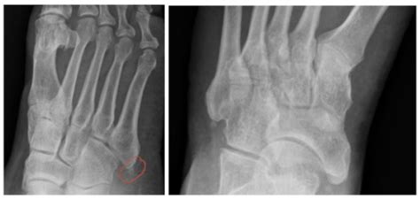 Radiology Self Assessment 1 Flashcards Quizlet