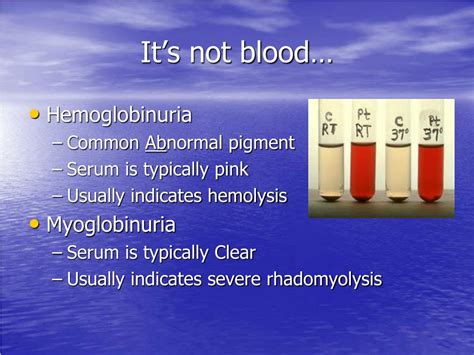 Hemoglobinuria Vs Myoglobinuria