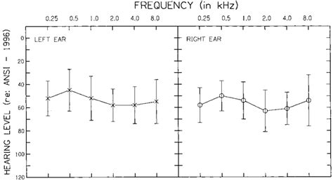 Mean Thresholds In DB HL As A Function Of Frequency For The Left Download Scientific Diagram