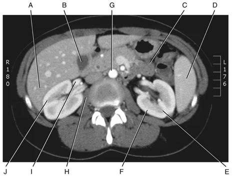 Ct Axial Diagram Quizlet