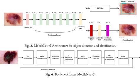 Figure 1 From Android Skin Cancer Detection And Classification Based On Mobilenet V2 Model