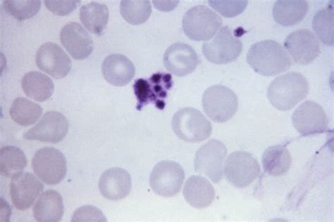 Free Picture Photo Micrograph Ring Form Plasmodium Falciparum