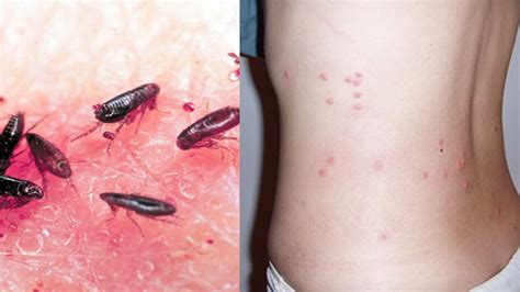 3 Best Way To Get Rid Of Fleas In The House How To Kill Fleas In 12