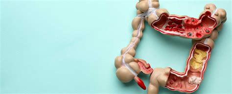 At Home Alternatives To Colonoscopy Henry Ford Health Detroit Mi