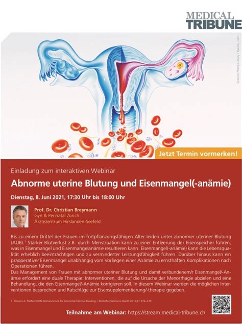 Blutung Und Eisenmangel Anämie Webinar Vom 8 Juni 2021