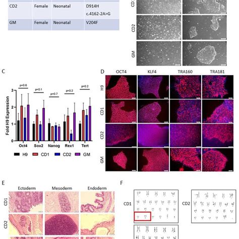 Characterization Of Patient Derived Ipscs A Table Detailing The