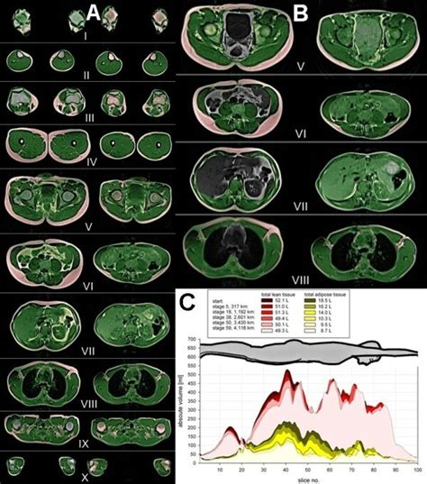 Semiautomatic Tissue Separation With Mobile Whole Body Mri Of A Download Scientific Diagram