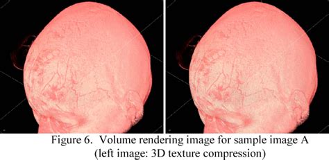 Figure 6 From Development Of A Volume Rendering System Using 3d Texture Compression Techniques