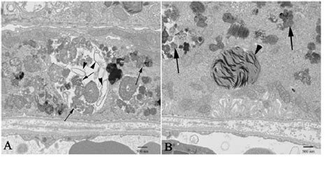 At Higher Magnification Prominent Features Of Rpe Cells From