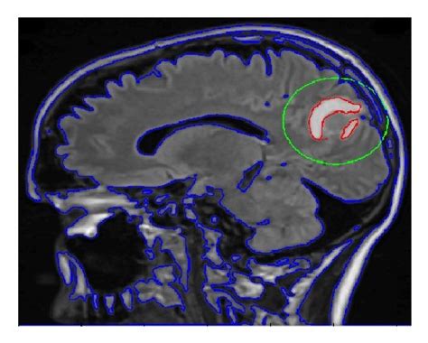 The Visual Results Comparison Between Segmentation Results Of The Download Scientific Diagram