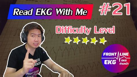 EP 21 Regular Wide QRS Read EKG With Me Frontline EKG YouTube