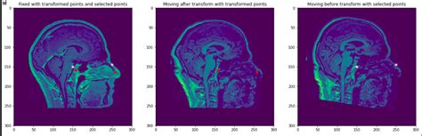 Inverse Transform Of Scalp Points Not Working As Expected · Issue 257