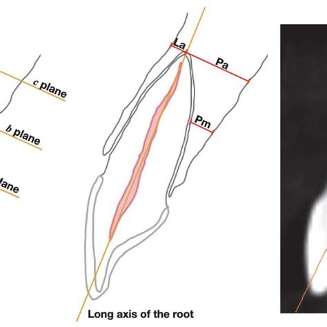 The Sagittal Root Position Classification As Reported By Kan Et Al 5