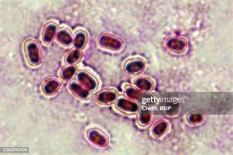 pneumococcus pneumococcus is a bacteria involved in pneumonia