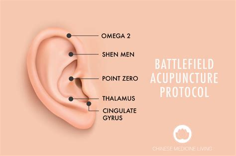 Pin On Auricular Acupuncture
