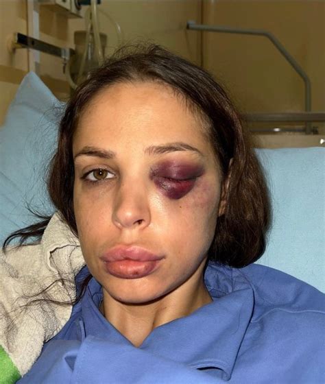 SPREMAJ SINU VAZELIN ZA ZATVOR Šavija brutalno odgovorila Osmanu