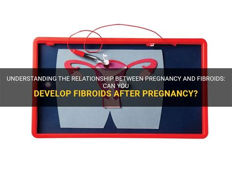 Understanding The Relationship Between Pregnancy And Fibroids Can You
