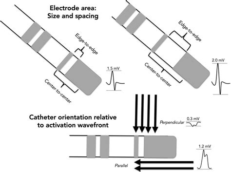 Determinants Of Bipolar Amplitude Electrode Area And Catheter Download Scientific Diagram